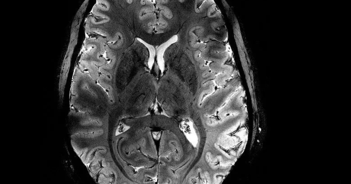 Ongekend scherp beeld van de hersenen uit een Franse MRI-scanner ...